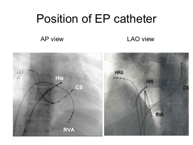 Cardiac Anatomy_20120916_南區