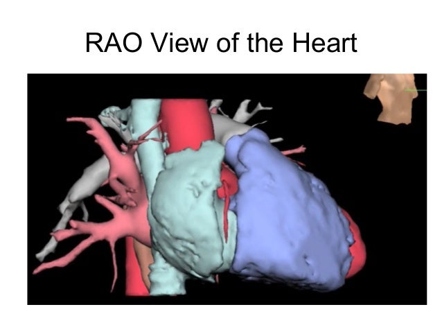 Cardiac Anatomy_20120916_南區