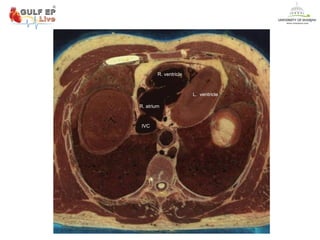 Cardiac anatomy in ep akram - eladl - adel | PPT