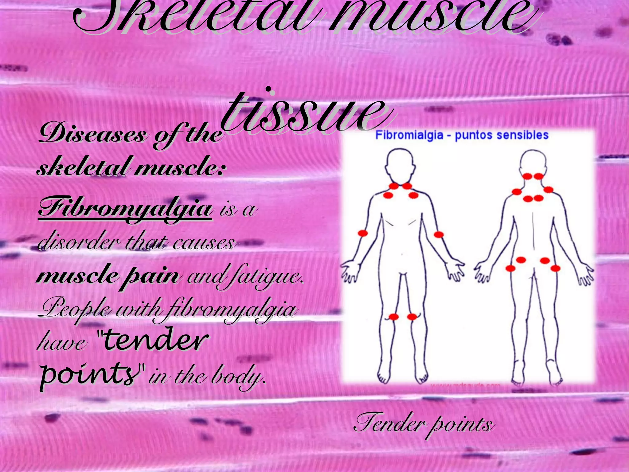 Cardiac and skeletal muscles1 | PPT