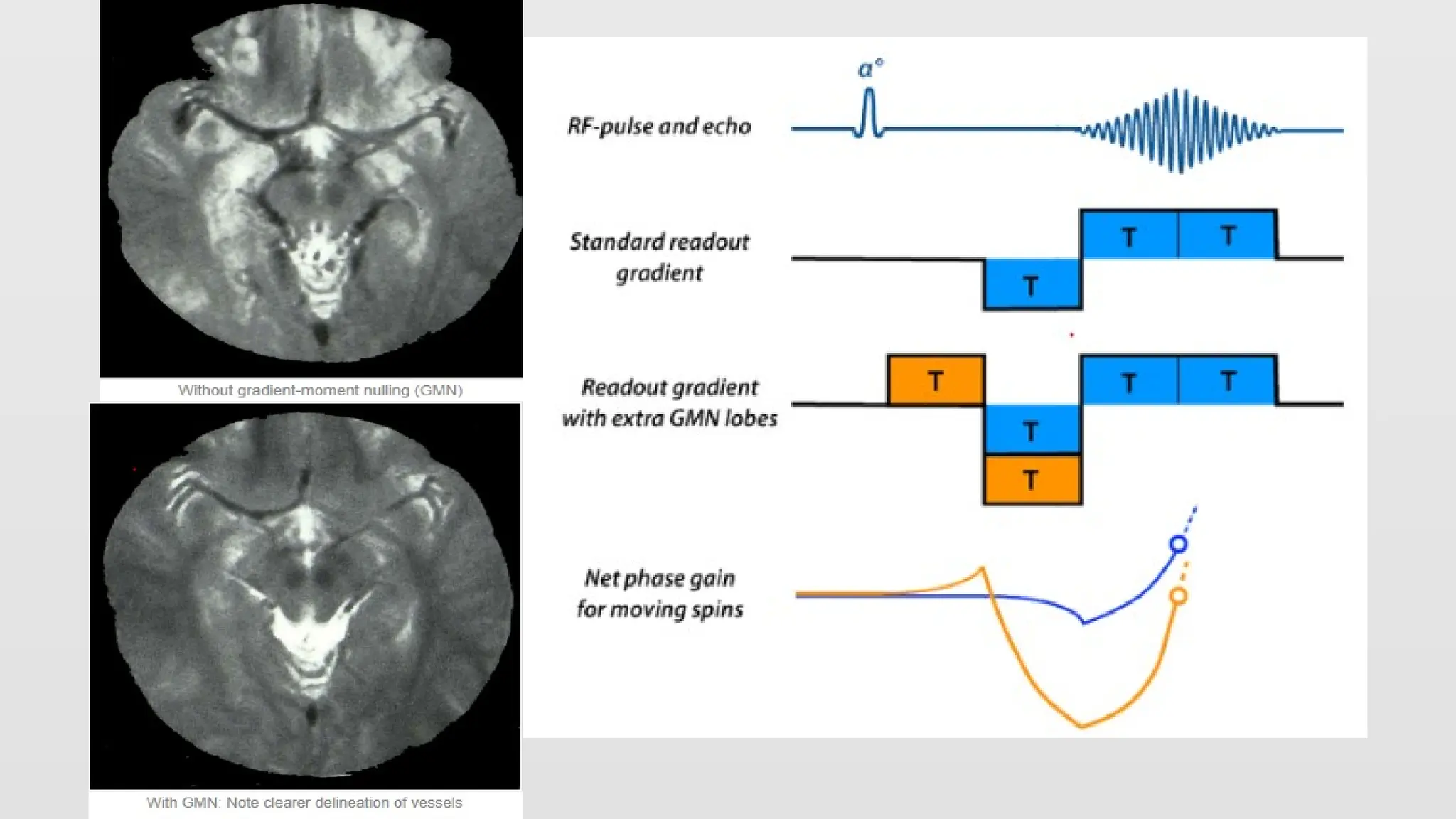 Cardiac and Vascular Imaging PPT.pptxpptx good | PPTX