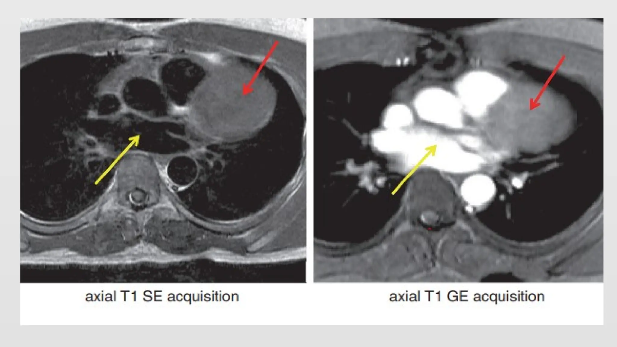 Cardiac and Vascular Imaging PPT.pptxpptx good | PPTX