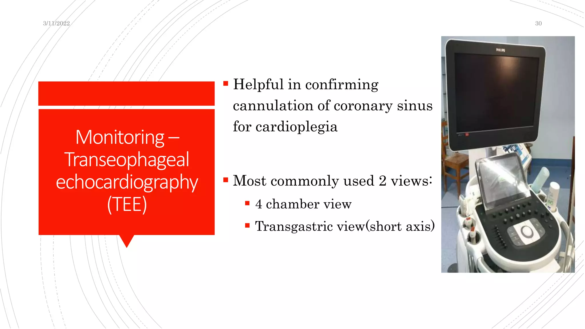 Introduction to Cardiac anesthesia | PPTX