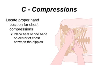 anasethesia.Cardiac arrest.(dr.amer) | PPT