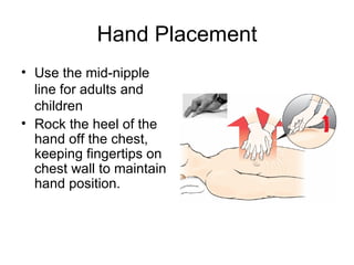 anasethesia.Cardiac arrest.(dr.amer) | PPT