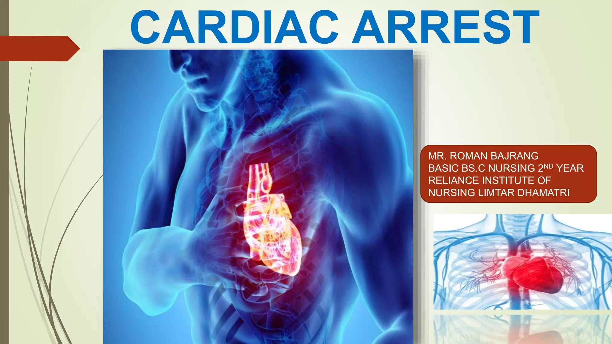 Cardiac arrest | PPTX