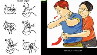 Cardiac arrest | PPTX