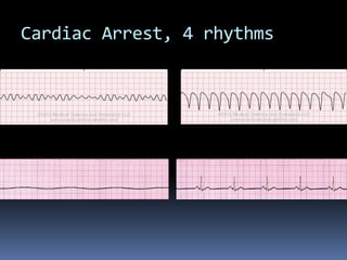 Cardiac arrest | PPTX