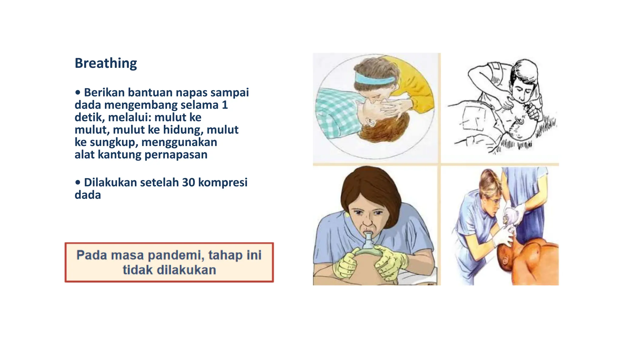 Cardiac Arrest (Henti jantung) penyebab.pptx