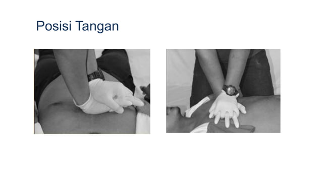 Cardiac Arrest (Henti jantung) penyebab.pptx