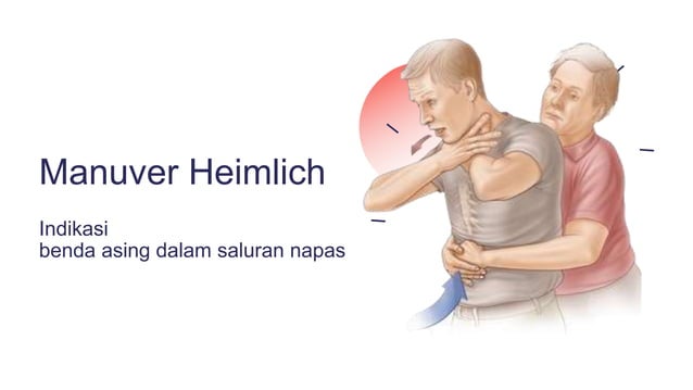 Cardiac Arrest (Henti jantung) penyebab.pptx