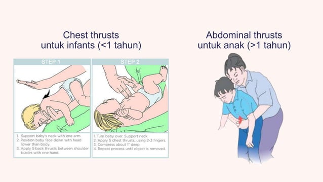 Cardiac Arrest (Henti jantung) penyebab.pptx