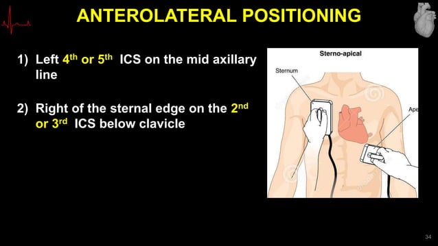 Cardiac arrest an overview of defibrillation vs cardioversion | PPTX ...