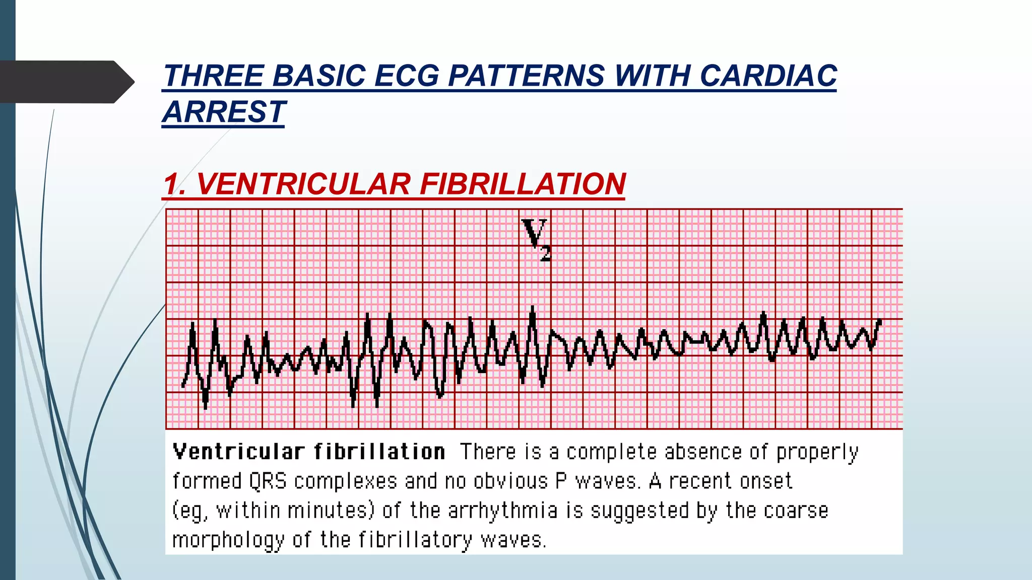 Cardiac arrest bsc | PPTX