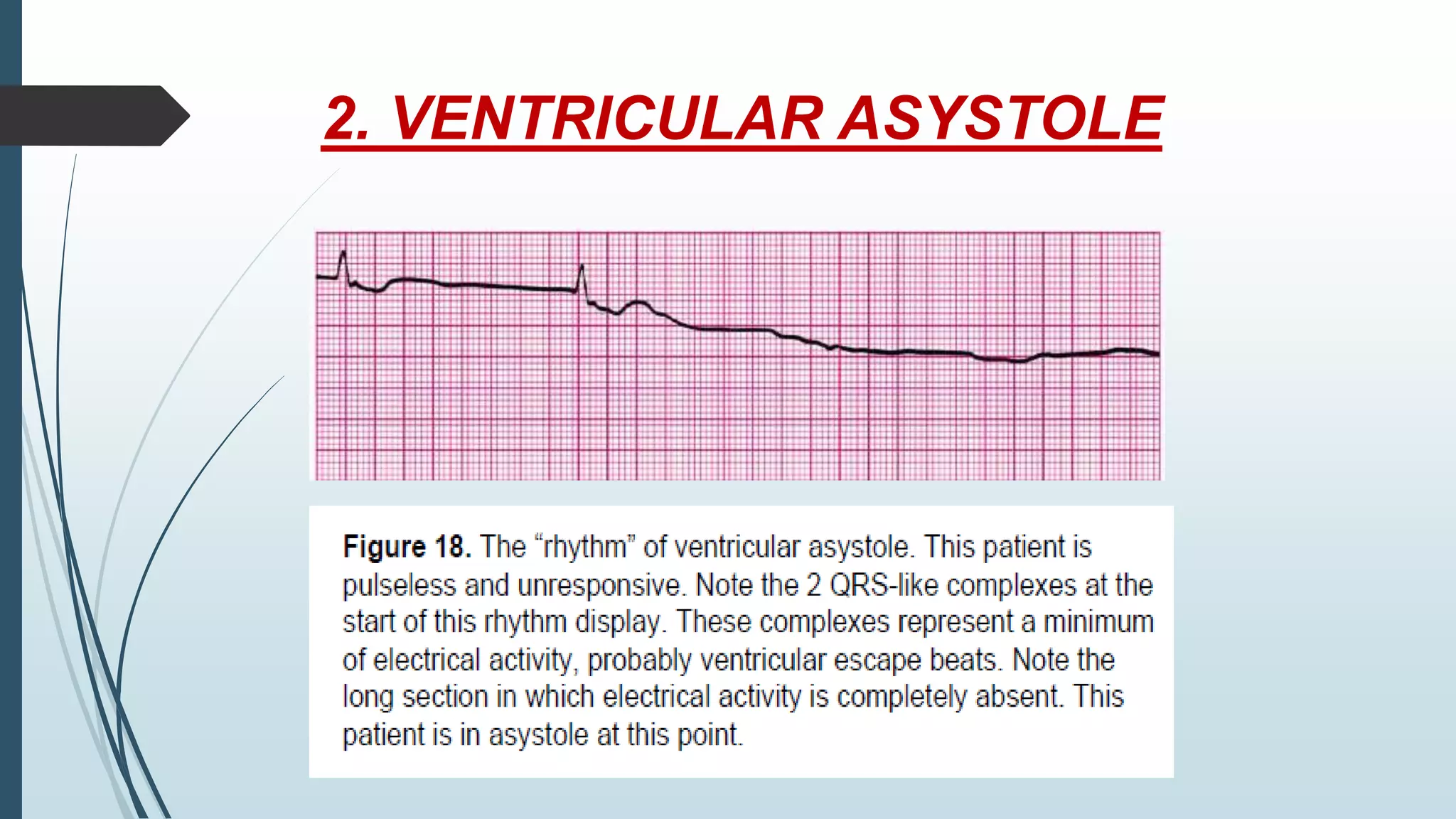 Cardiac arrest bsc | PPTX