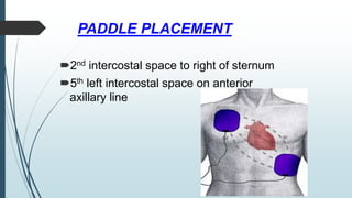 Cardiac arrest bsc | PPTX