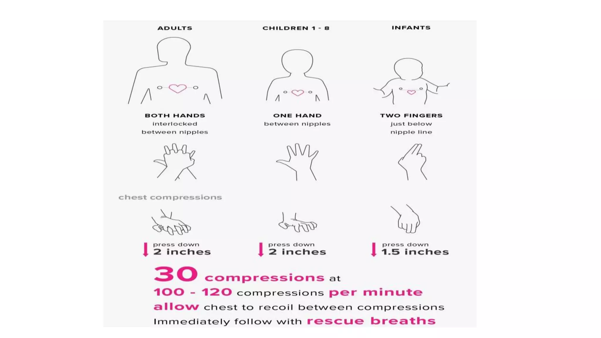 Cardiac arrest cpr shock | PPTX | First Aid | Injuries