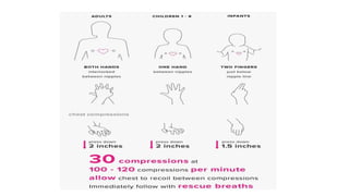 Cardiac arrest cpr shock | PPTX | First Aid | Injuries