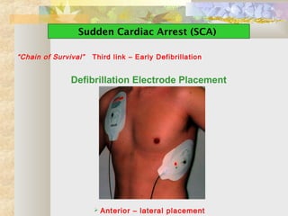 Cardiac arrest resuscitation simi joju k. | PPT