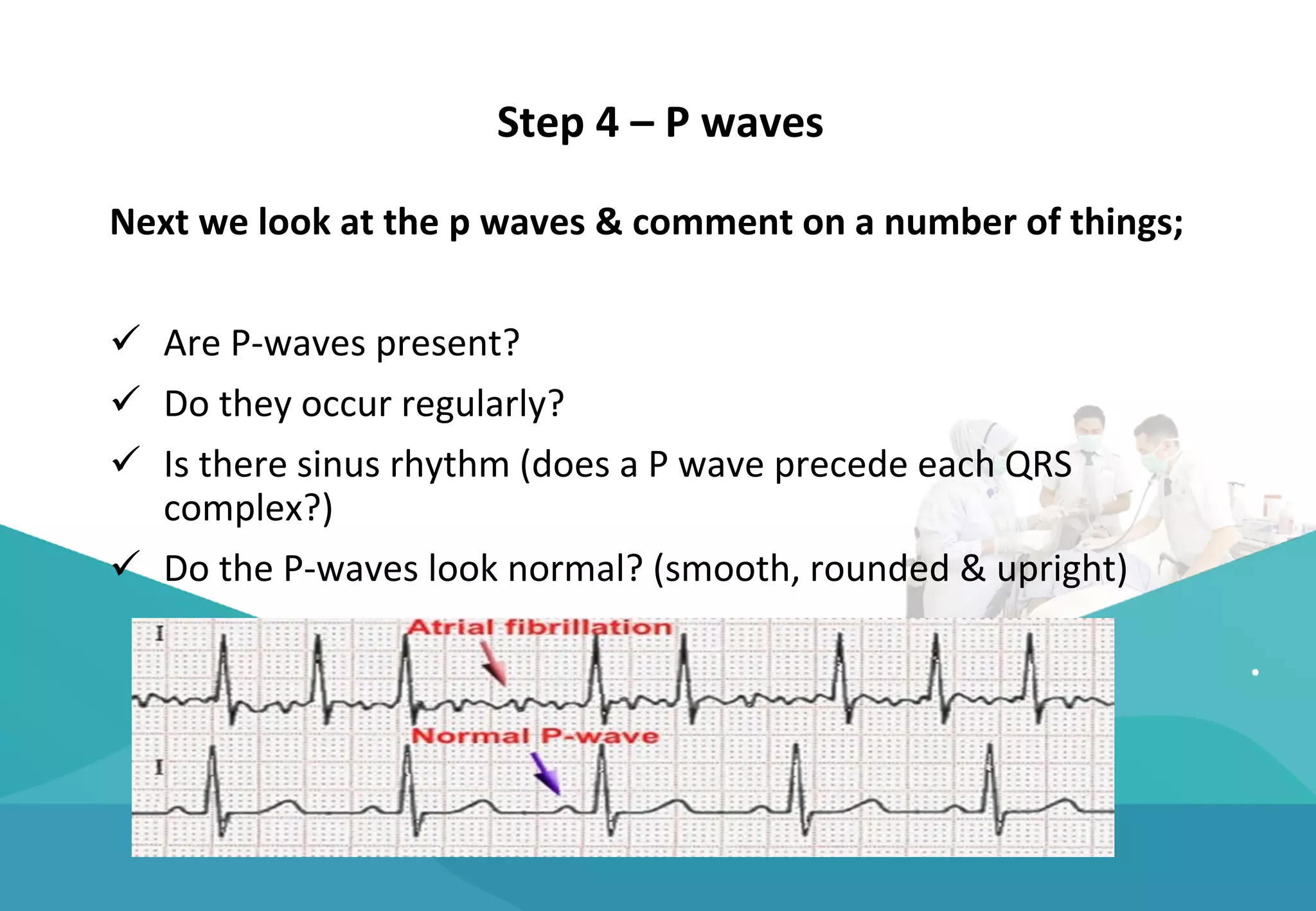Cardiac Arrest Rhythm.pdf