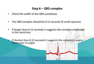Cardiac Arrest Rhythm.pdf
