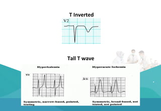 Cardiac Arrest Rhythm.pdf