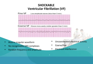 Cardiac Arrest Rhythm.pdf