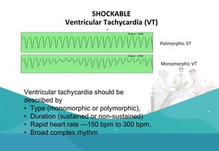 Cardiac Arrest Rhythm.pdf