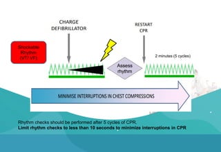 Cardiac Arrest Rhythm.pdf