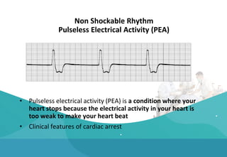 Cardiac Arrest Rhythm.pdf