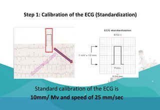 Cardiac Arrest Rhythm.pdf