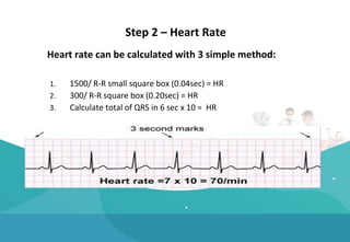 Cardiac Arrest Rhythm.pdf