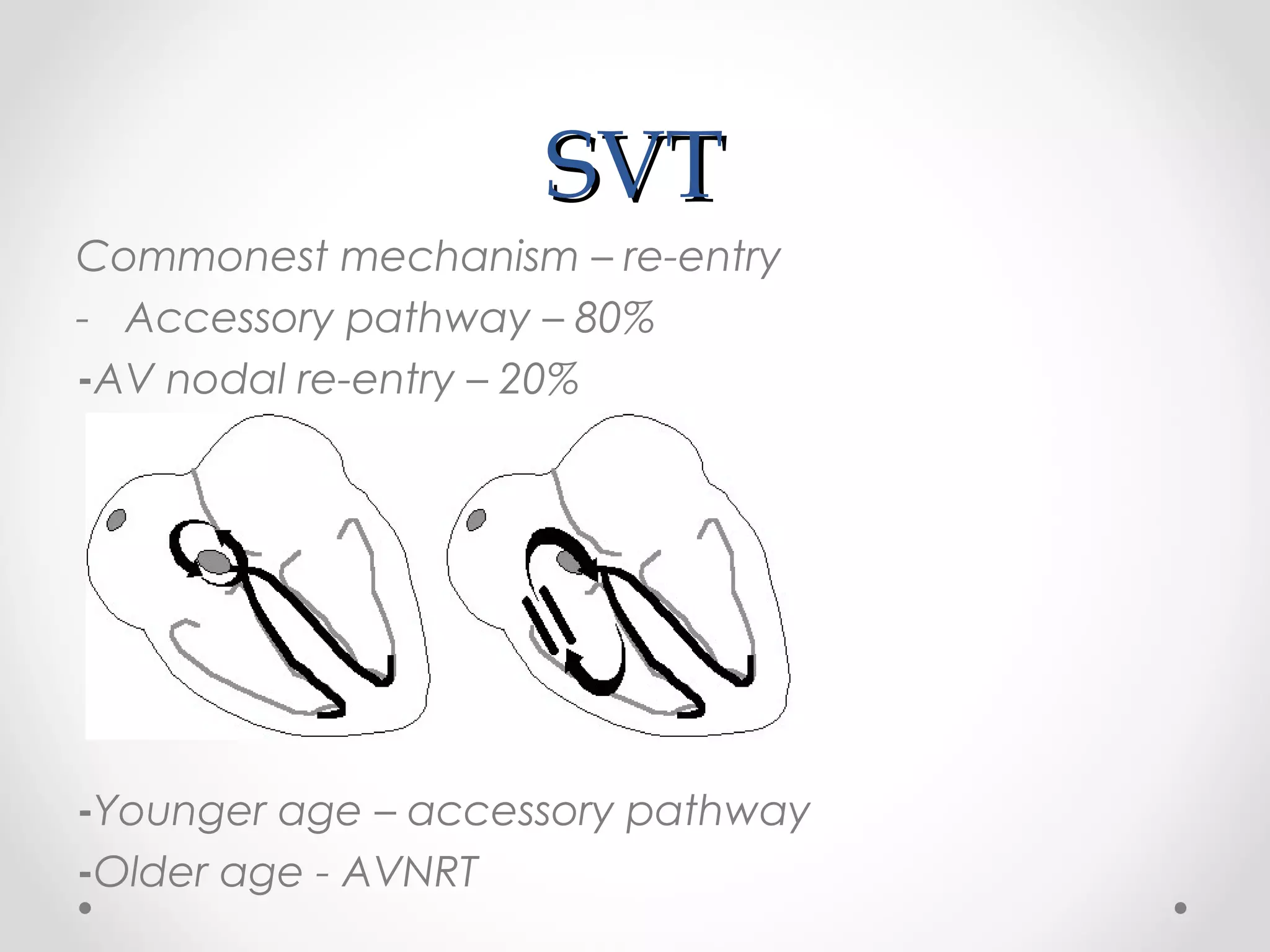 SVT in pediatrics | PPT