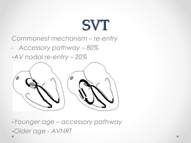 SVT in pediatrics | PPT | Heart and Cardiovascular Diseases | Diseases ...
