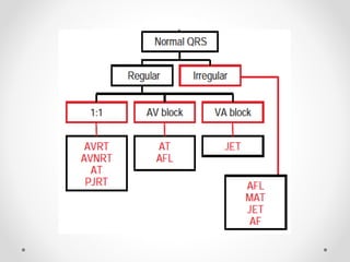 SVT in pediatrics | PPT
