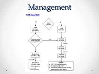 SVT in pediatrics | PPT