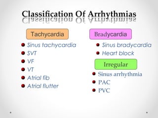 SVT in pediatrics | PPT