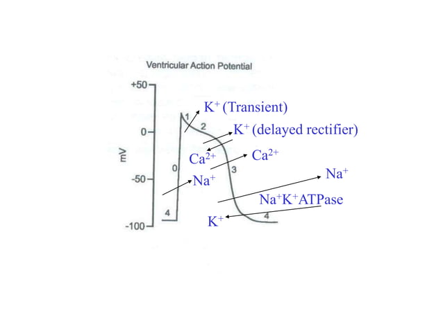 CARDIAC ARRHYTHMIA PPT ASASASASASSSS.ppt