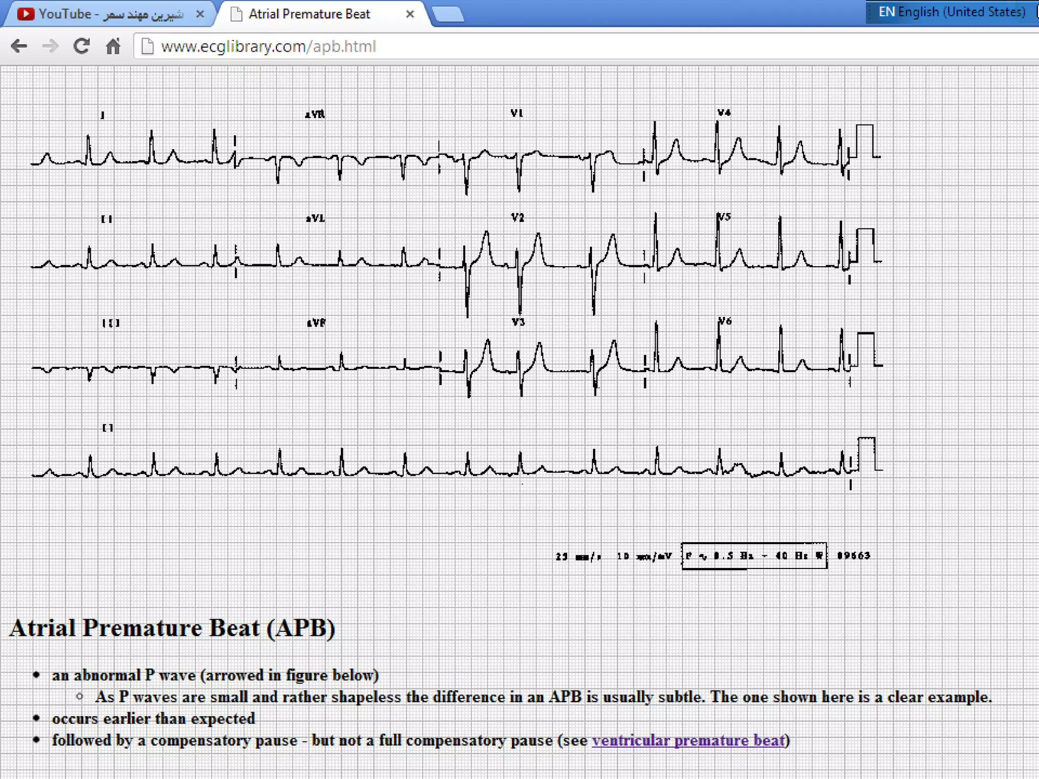 Arrhythmia broad overview | PPT