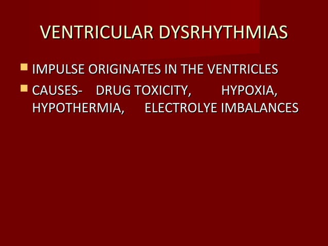 Arrhythmia broad overview | PPT