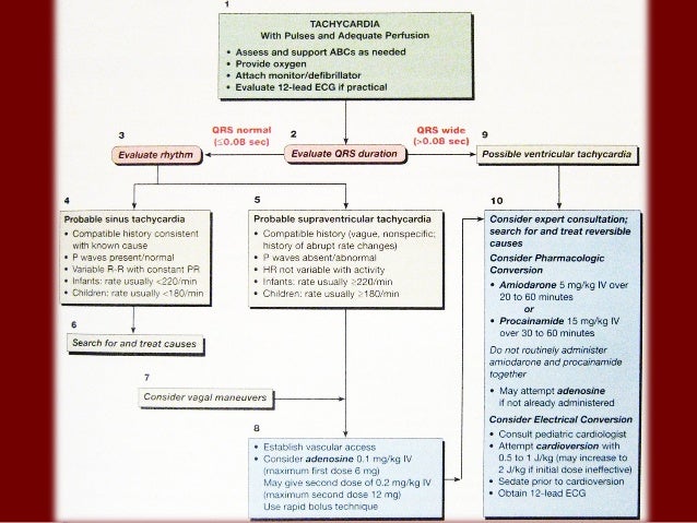 Arrhythmia broad overview