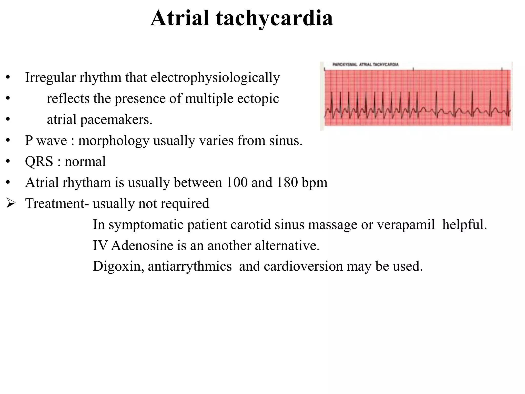 CARDIAC ARRHYTHMIA (1).pptx