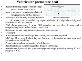 CARDIAC ARRHYTHMIA (1).pptx