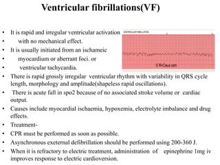 CARDIAC ARRHYTHMIA (1).pptx