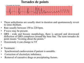 CARDIAC ARRHYTHMIA (1).pptx