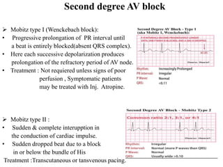 CARDIAC ARRHYTHMIA (1).pptx