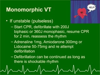 Cardiac arrhythmia1.ppt3