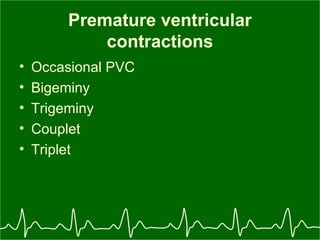 Cardiac arrhythmia1.ppt3