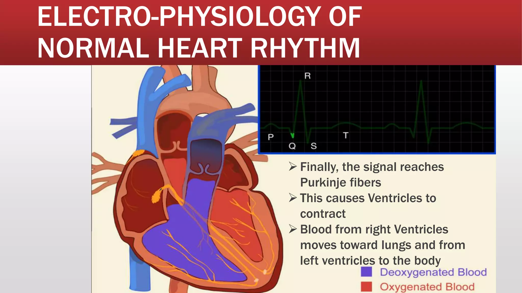 Cardiac arrhythmia and anti arrhythmic drugs | PPT