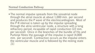 Cardiac arrhythmia by sharvari | PPTX
